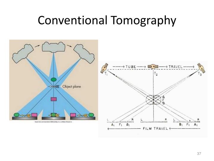 PPT - UNIT 2 X-ray Tube Review & Dedicated X-ray machines PowerPoint ...