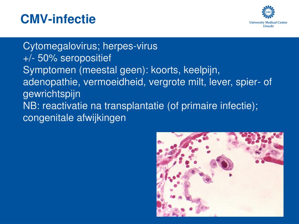PPT - De CMV EBV Tox rondzending PowerPoint Presentation, free download ...