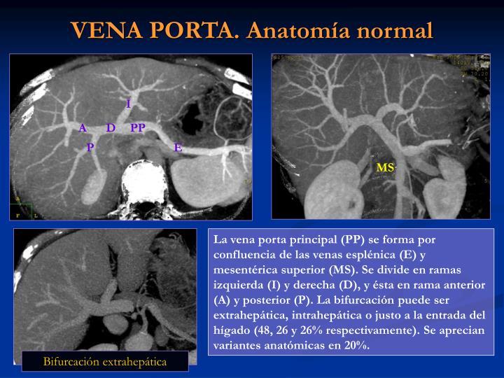 PPT - TRASPLANTE HEPÁTICO PowerPoint Presentation - ID:3382844