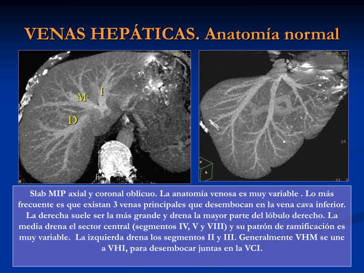 PPT - TRASPLANTE HEPÁTICO PowerPoint Presentation - ID:3382844