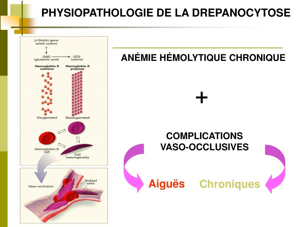PPT - Problèmes cliniques émergents chez l’adulte drépanocytaire ...