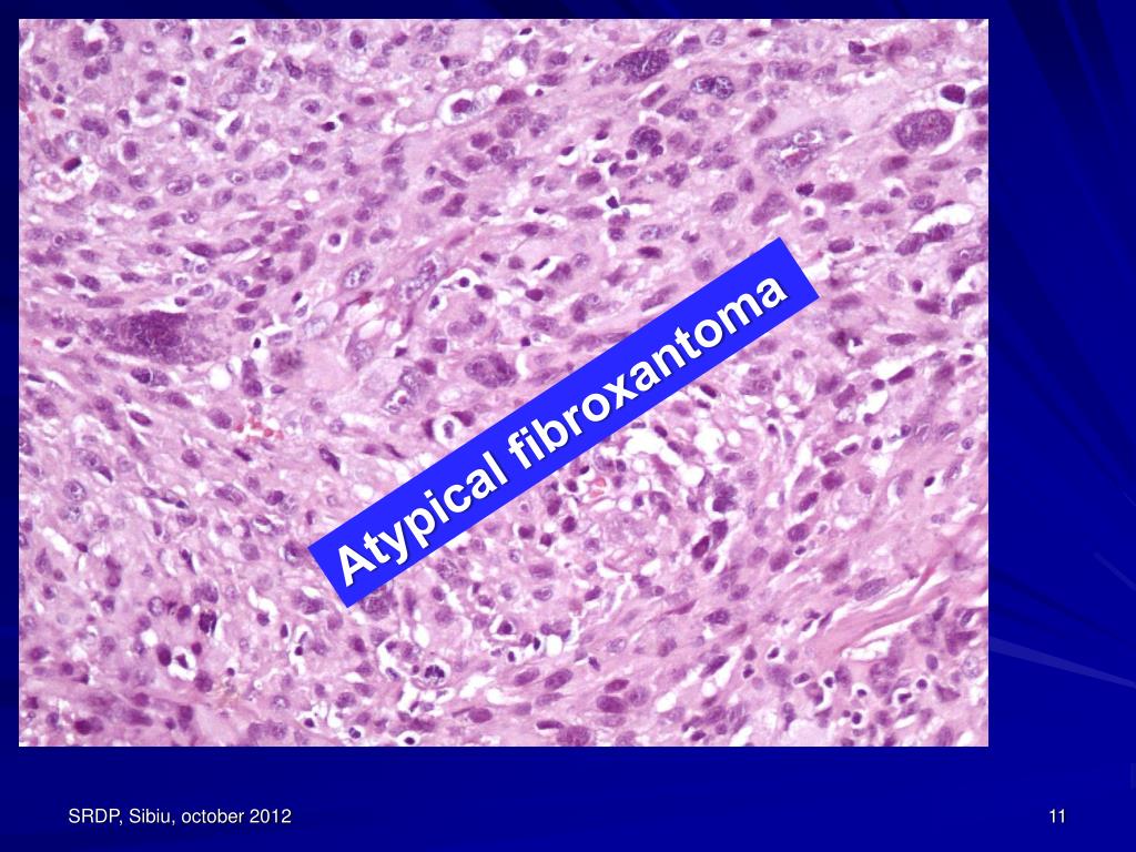 PPT - Case 1 PowerPoint Presentation, free download - ID:3383586