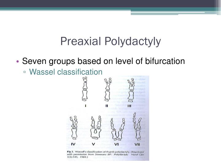 PPT - Polydactyly PowerPoint Presentation - ID:3383975