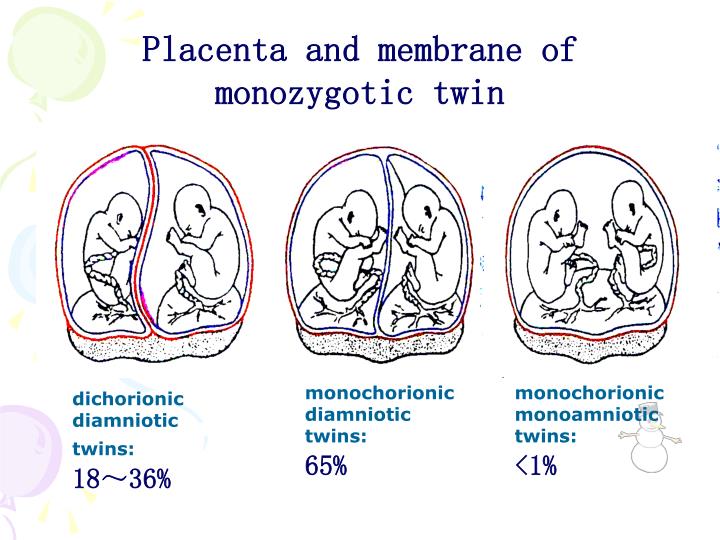 PPT - Twin Pregnancy PowerPoint Presentation - ID:3384081
