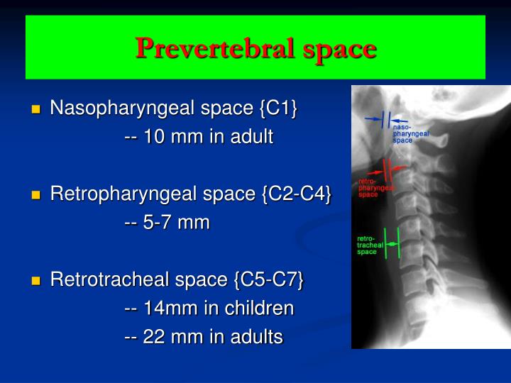PPT - Dr. Ahmed Refaey PowerPoint Presentation - ID:3386636