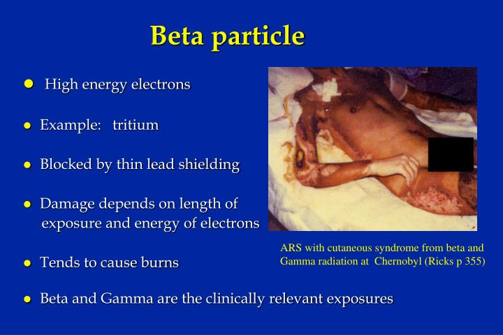 PPT - The Burn Center and Radiation Incidents PowerPoint Presentation ...