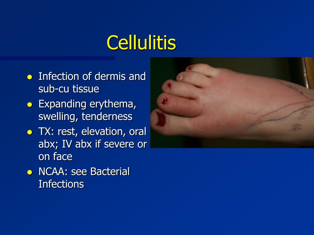 PPT - Sports Dermatology PowerPoint Presentation, free download - ID ...