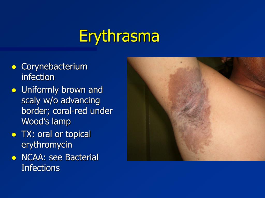 PPT - Sports Dermatology PowerPoint Presentation, free download - ID ...