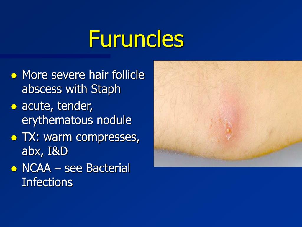 PPT - Sports Dermatology PowerPoint Presentation, free download - ID ...