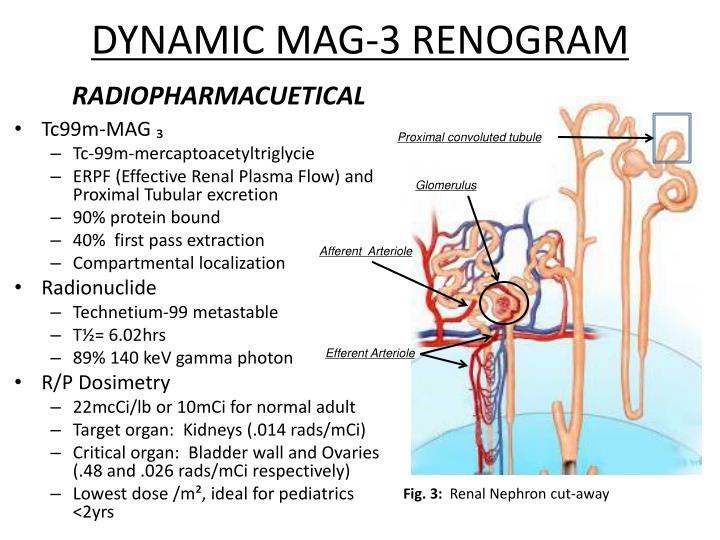 PPT - Crossed-Fused Renal Ectopia imaged with Tc99m-MAG₃ PowerPoint ...