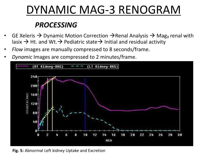 PPT - Crossed-Fused Renal Ectopia imaged with Tc99m-MAG₃ PowerPoint ...