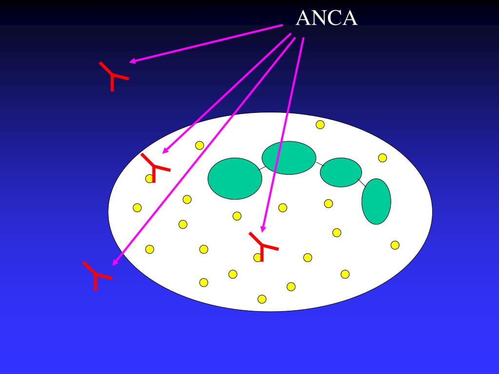 PPT - The use of antineutrophil antibodies in the diagnosis and ...