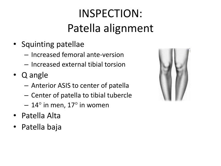 PPT - EXAMINATION OF THE KNEE PowerPoint Presentation - ID:3391057