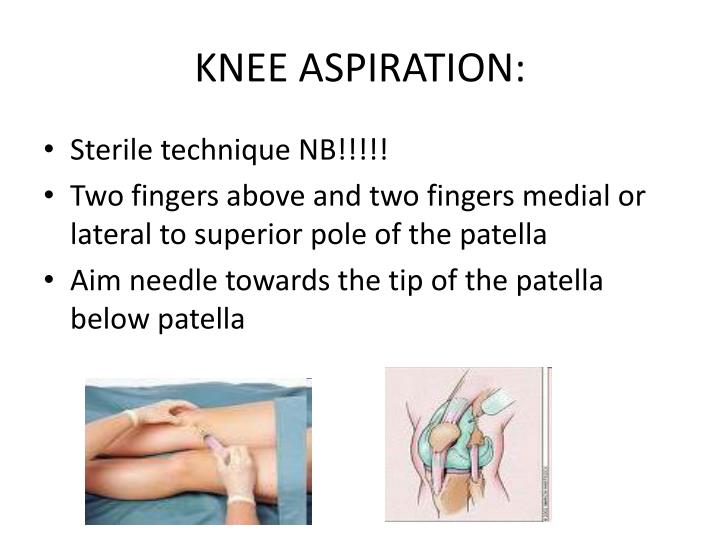 PPT - EXAMINATION OF THE KNEE PowerPoint Presentation - ID:3391057
