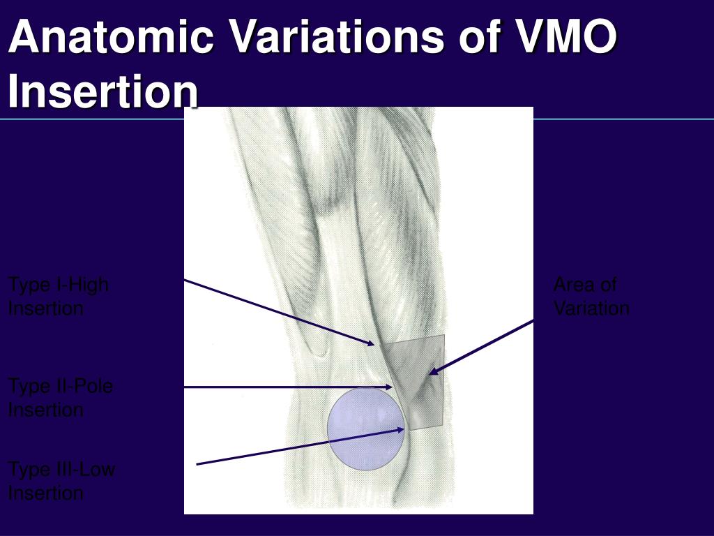 PPT - Frank R. Ebert, MD Union Memorial Hospital Baltimore, Maryland ...