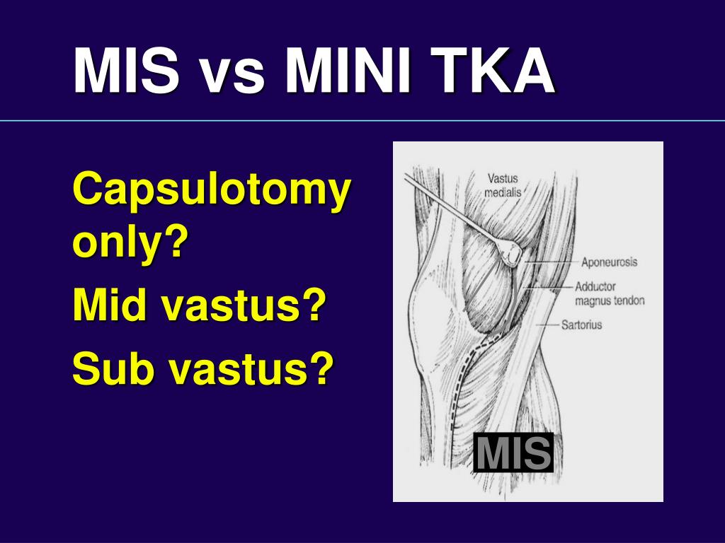 PPT - Frank R. Ebert, MD Union Memorial Hospital Baltimore, Maryland ...