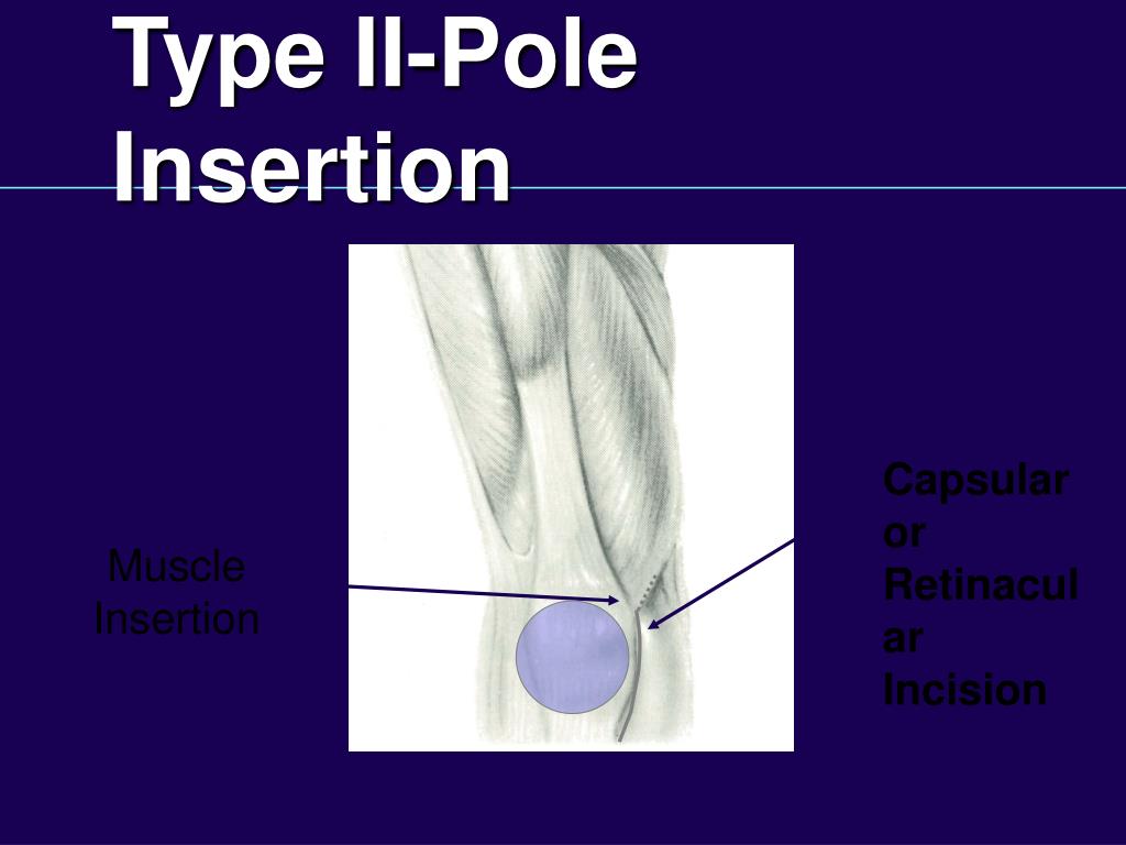 PPT - Frank R. Ebert, MD Union Memorial Hospital Baltimore, Maryland ...