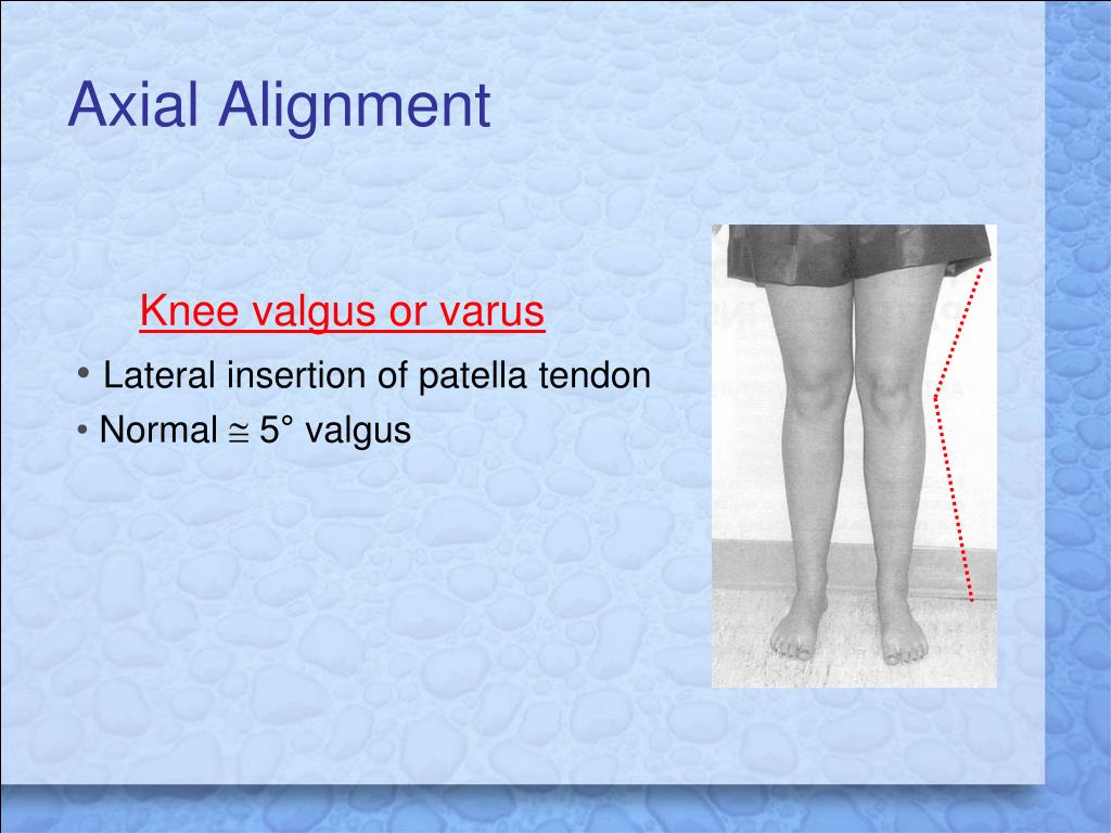PPT - Lonnie E. Paulos, MD Medical Director The Andrews-Paulos Research ...