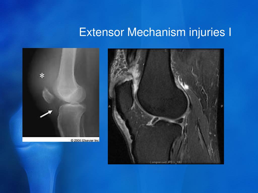 PPT - Clinical Anatomy of the knee PowerPoint Presentation, free ...