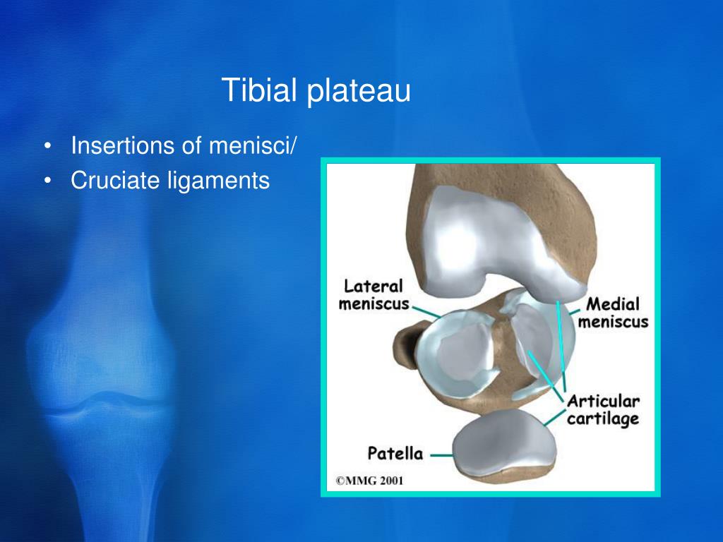 PPT - Clinical Anatomy of the knee PowerPoint Presentation, free ...