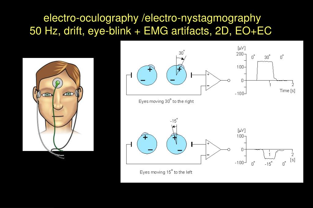 PPT - Department of ORL-HNS Maastricht University Medical Centre The ...