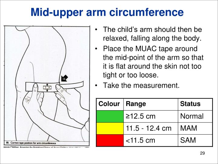 PPT - Integrated Management of Acute Malnutrition PowerPoint ...