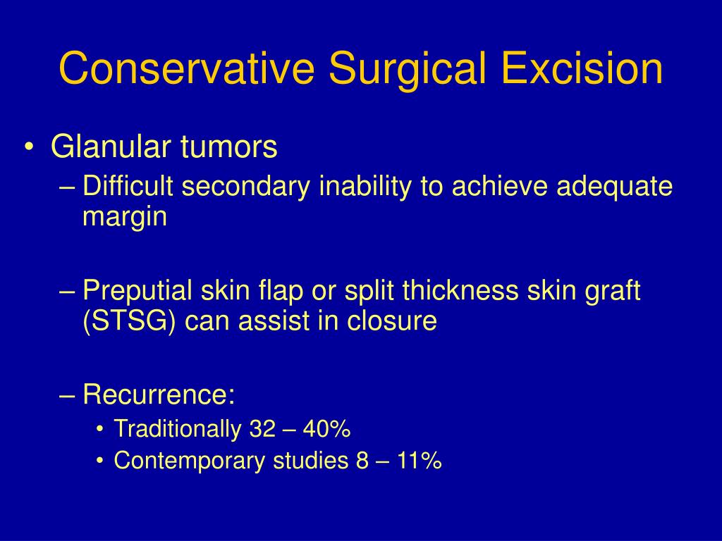 PPT - Surgery of Penile and Urethral Carcinoma PowerPoint Presentation ...