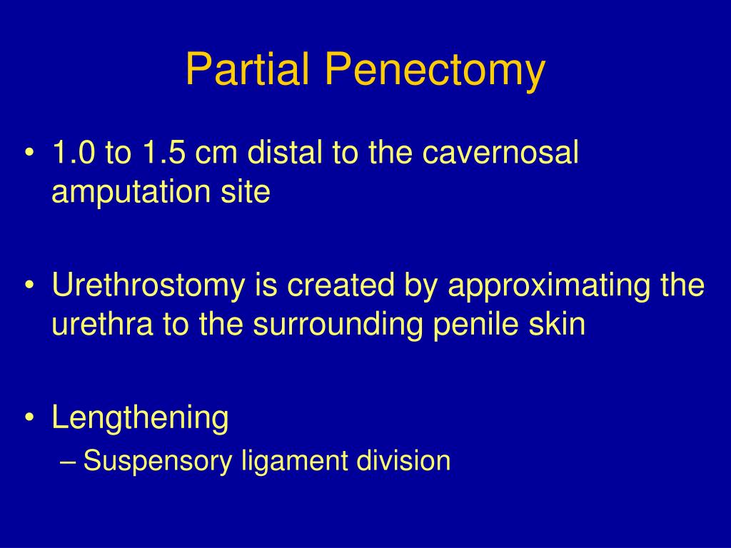 PPT - Surgery of Penile and Urethral Carcinoma PowerPoint Presentation ...