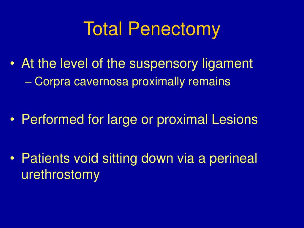 PPT - Surgery of Penile and Urethral Carcinoma PowerPoint Presentation ...