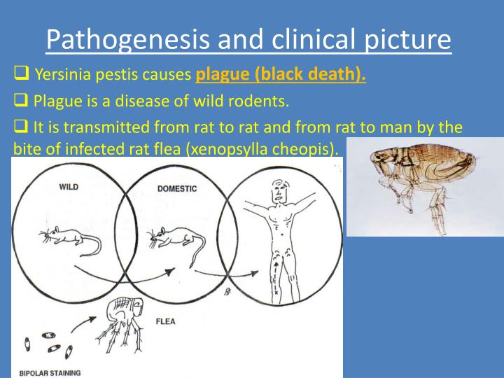 PPT - Yersinia PowerPoint Presentation - ID:3397453