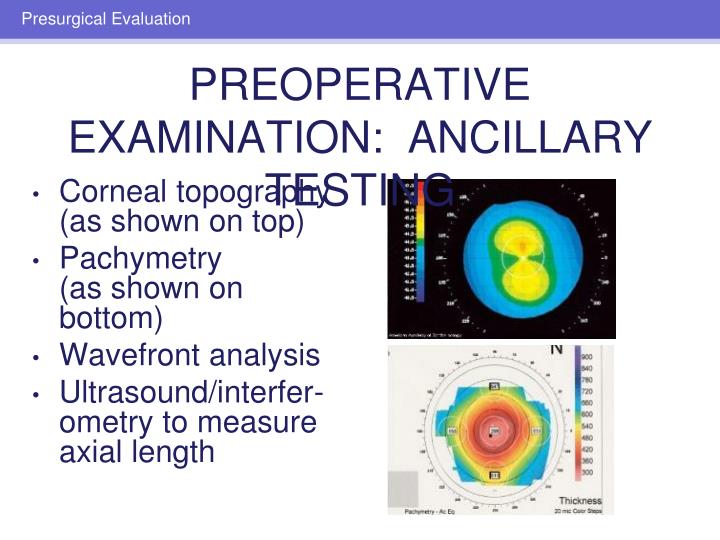 PPT - Refractive Surgery PowerPoint Presentation - ID:3398255