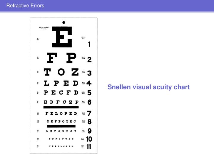 PPT - Refractive Surgery PowerPoint Presentation - ID:3398255