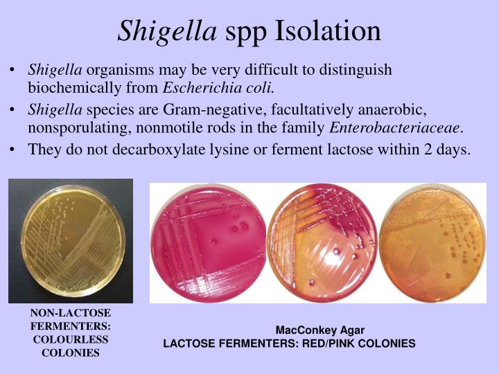 PPT - Shigella spp Isolation and Serotyping PowerPoint Presentation ...
