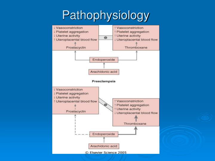 PPT - Pregnancy Induced Hypertension PowerPoint Presentation - ID:3399489