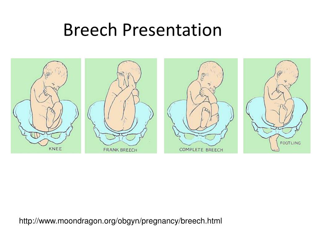 PPT - Reproductive Pathophysiology 2: Pregnancy and Female Infertility ...