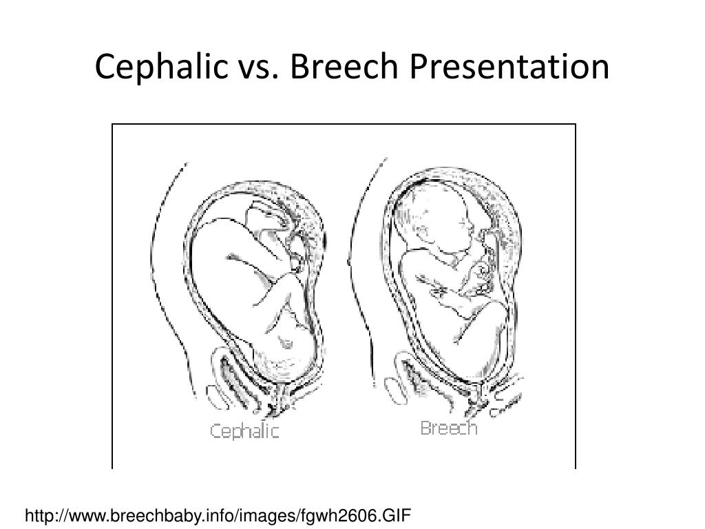 PPT - Reproductive Pathophysiology 2: Pregnancy and Female Infertility ...