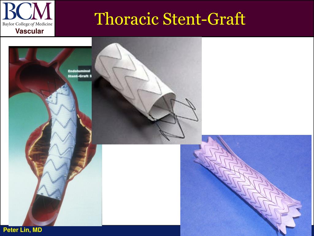 PPT - Southern Association for Vascular Surgery 2007 Postgraduate ...