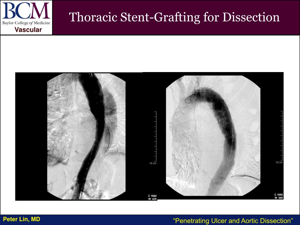 PPT - Southern Association for Vascular Surgery 2007 Postgraduate ...