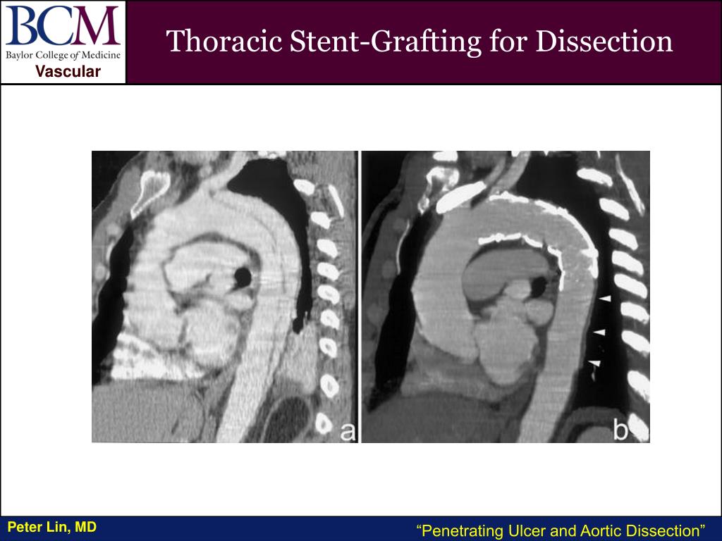 PPT - Southern Association for Vascular Surgery 2007 Postgraduate ...