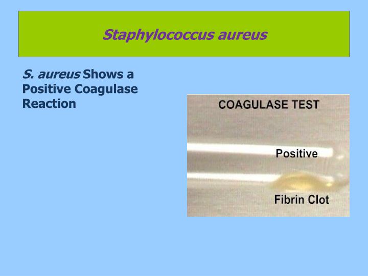 PPT - GI Bacteriology PowerPoint Presentation - ID:3400384
