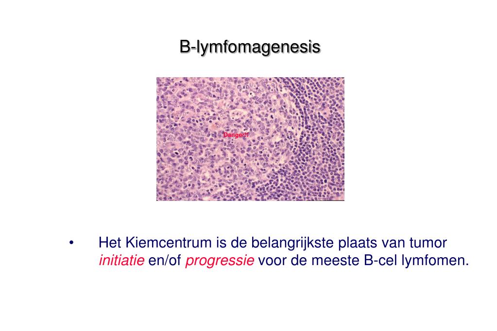 PPT - De (Moleculaire)biologie van Maligne Lymfomen Blok oncologie ...