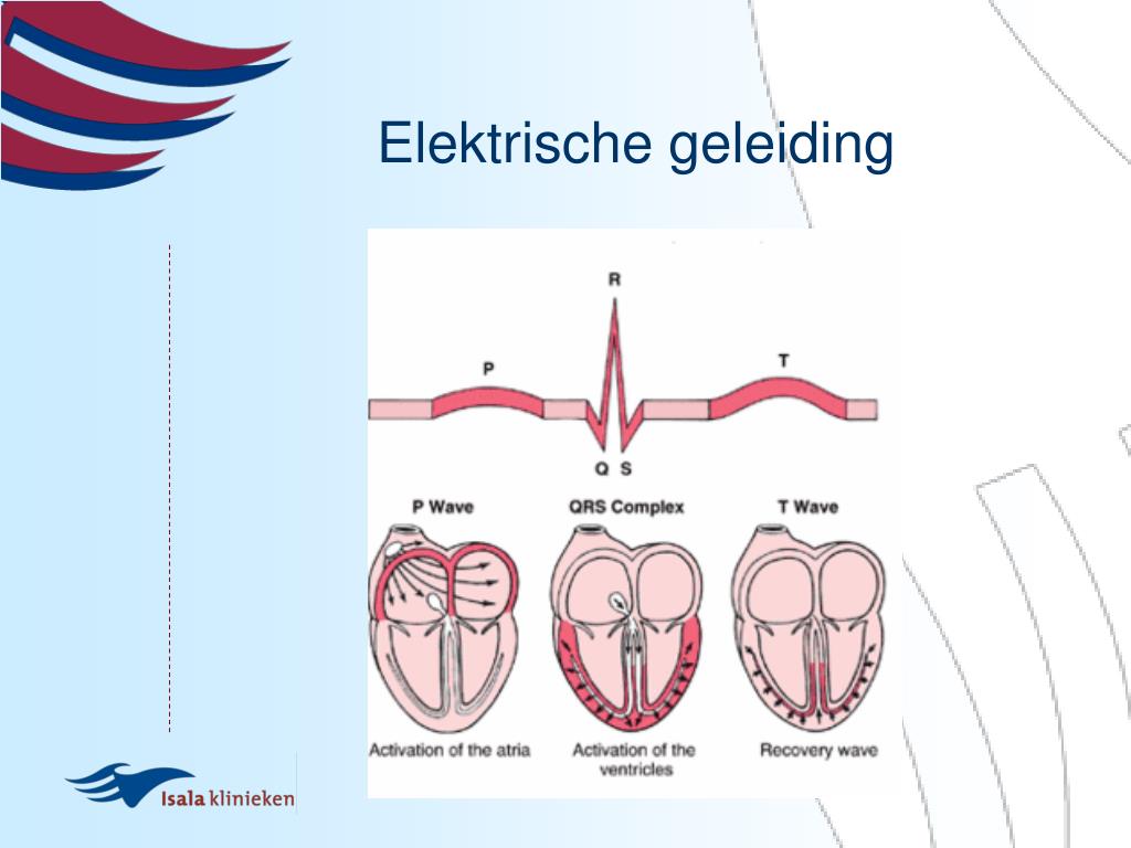 PPT - ECG-onderwijs: Ritme- en geleidingsstoornissen PowerPoint ...