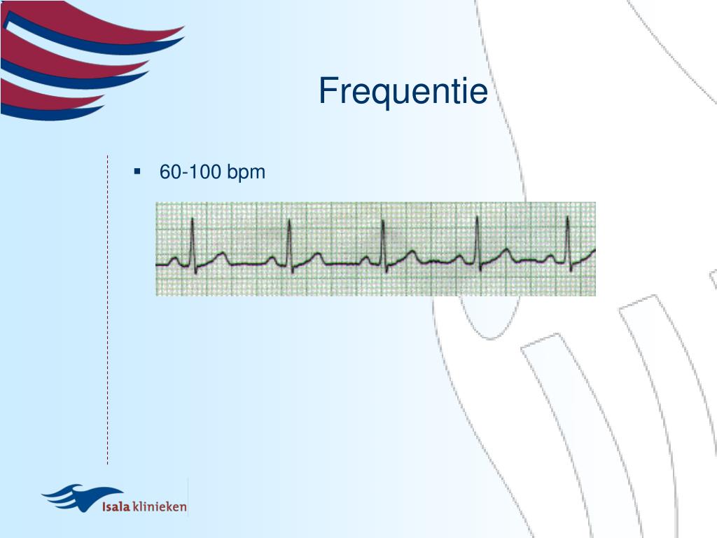 PPT - ECG-onderwijs: Ritme- en geleidingsstoornissen PowerPoint ...