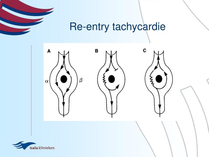 PPT - ECG-onderwijs: Ritme- en geleidingsstoornissen PowerPoint ...