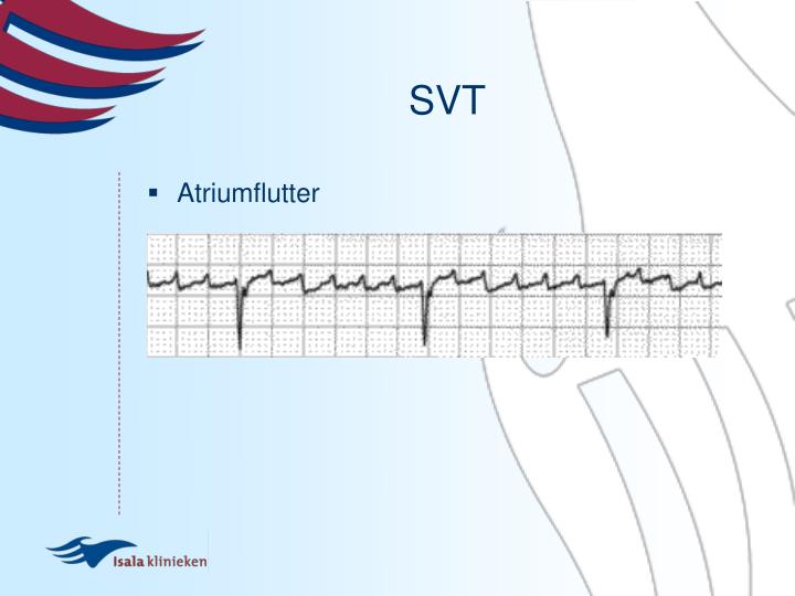 PPT - ECG-onderwijs: Ritme- en geleidingsstoornissen PowerPoint ...