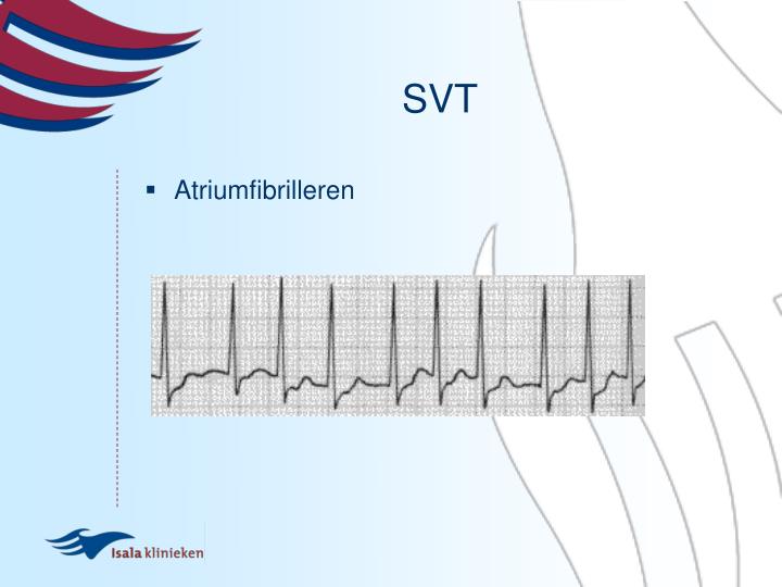 PPT - ECG-onderwijs: Ritme- en geleidingsstoornissen PowerPoint ...