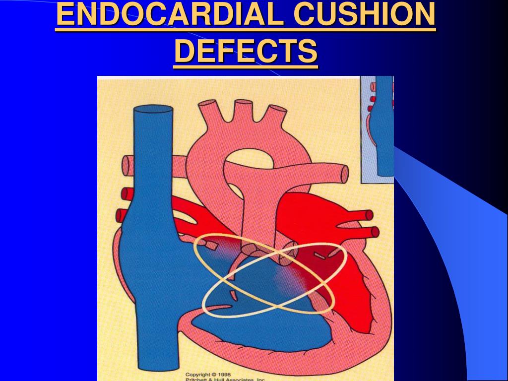PPT - Pediatric Board Review 2014 Pediatric Cardiology PowerPoint ...