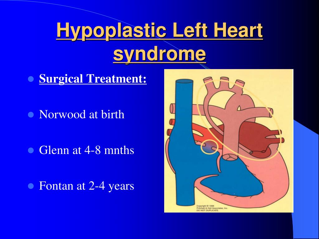 PPT - Pediatric Board Review 2014 Pediatric Cardiology PowerPoint ...