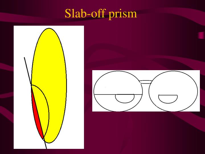 PPT - Legal Blindness PowerPoint Presentation - ID:3404385