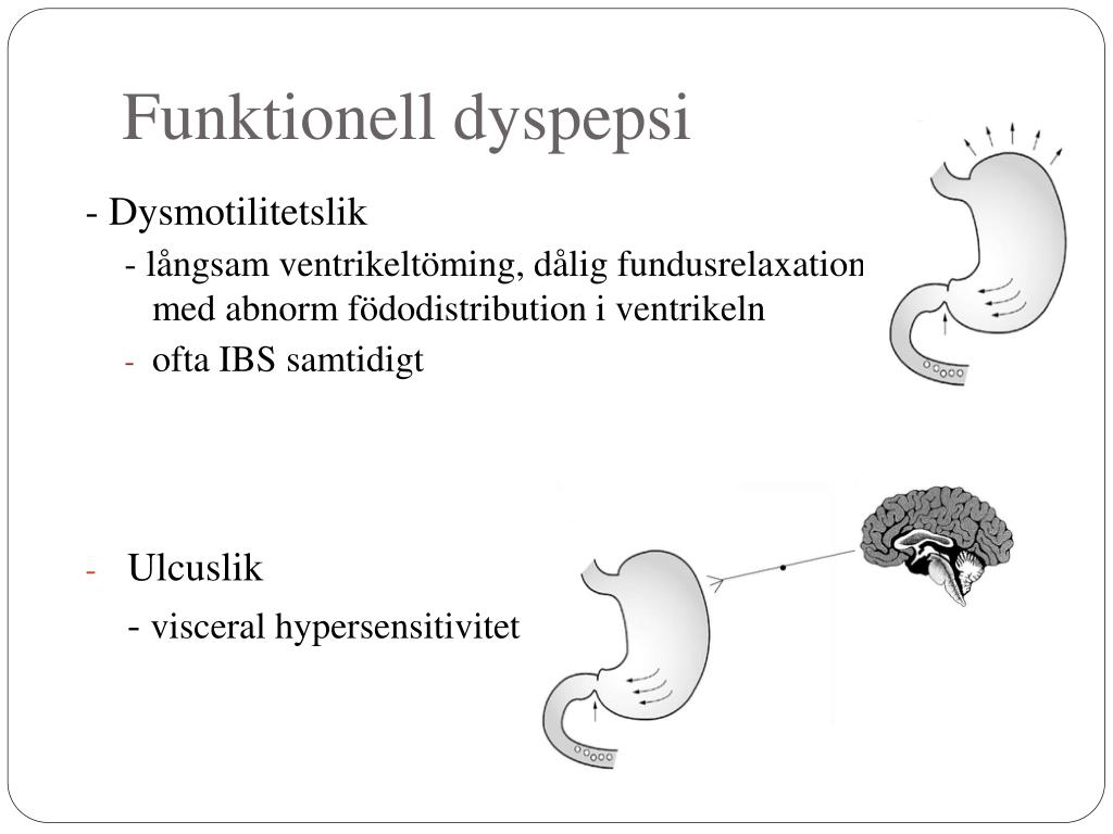 PPT - IBS - diagnostik , behandling och differentialdiagnoser Fredrik ...